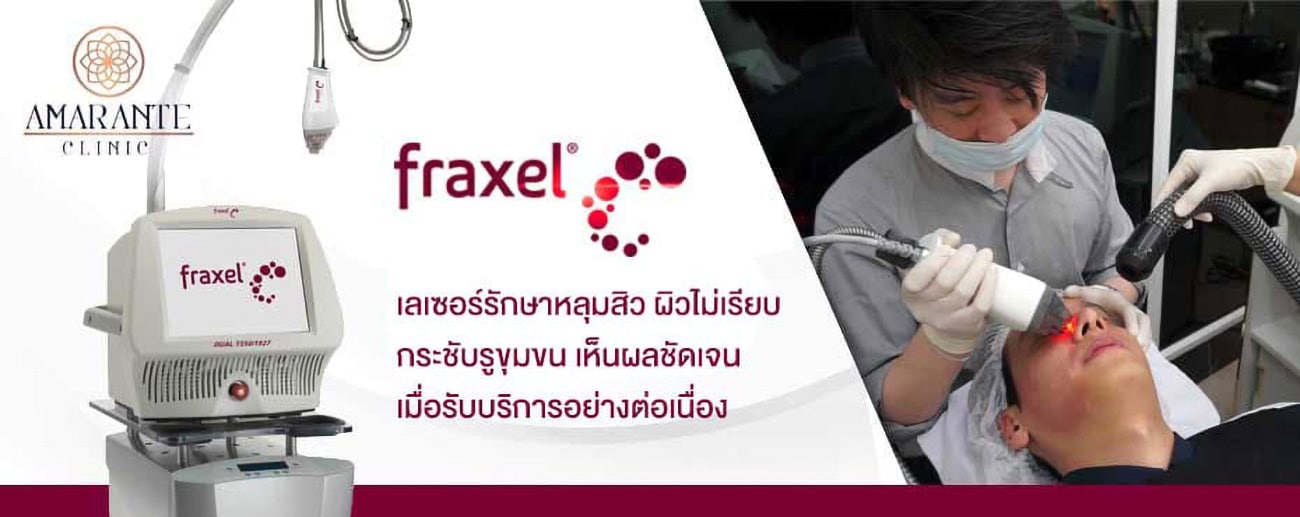 Fraxel Laser รักษาหลุมสิว